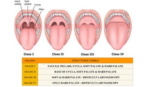 Airway Anatomy & Evaluation PPT.pptx
