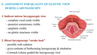 Airway Anatomy & Evaluation PPT.pptx