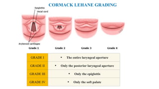 Airway Anatomy & Evaluation PPT.pptx