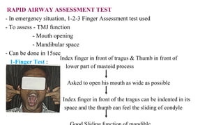 Airway Anatomy & Evaluation PPT.pptx