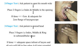 Airway Anatomy & Evaluation PPT.pptx