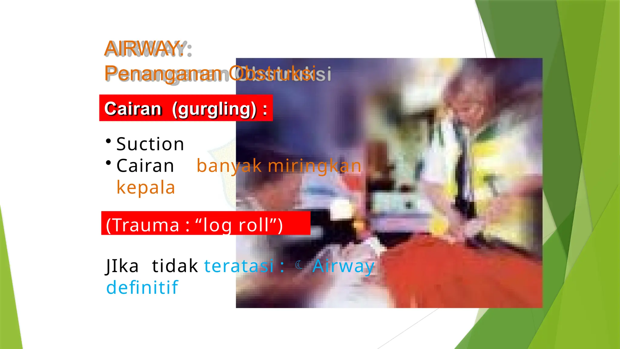 AIRWAY AND BREATHING MANAJEMEN OTISTA.pptx