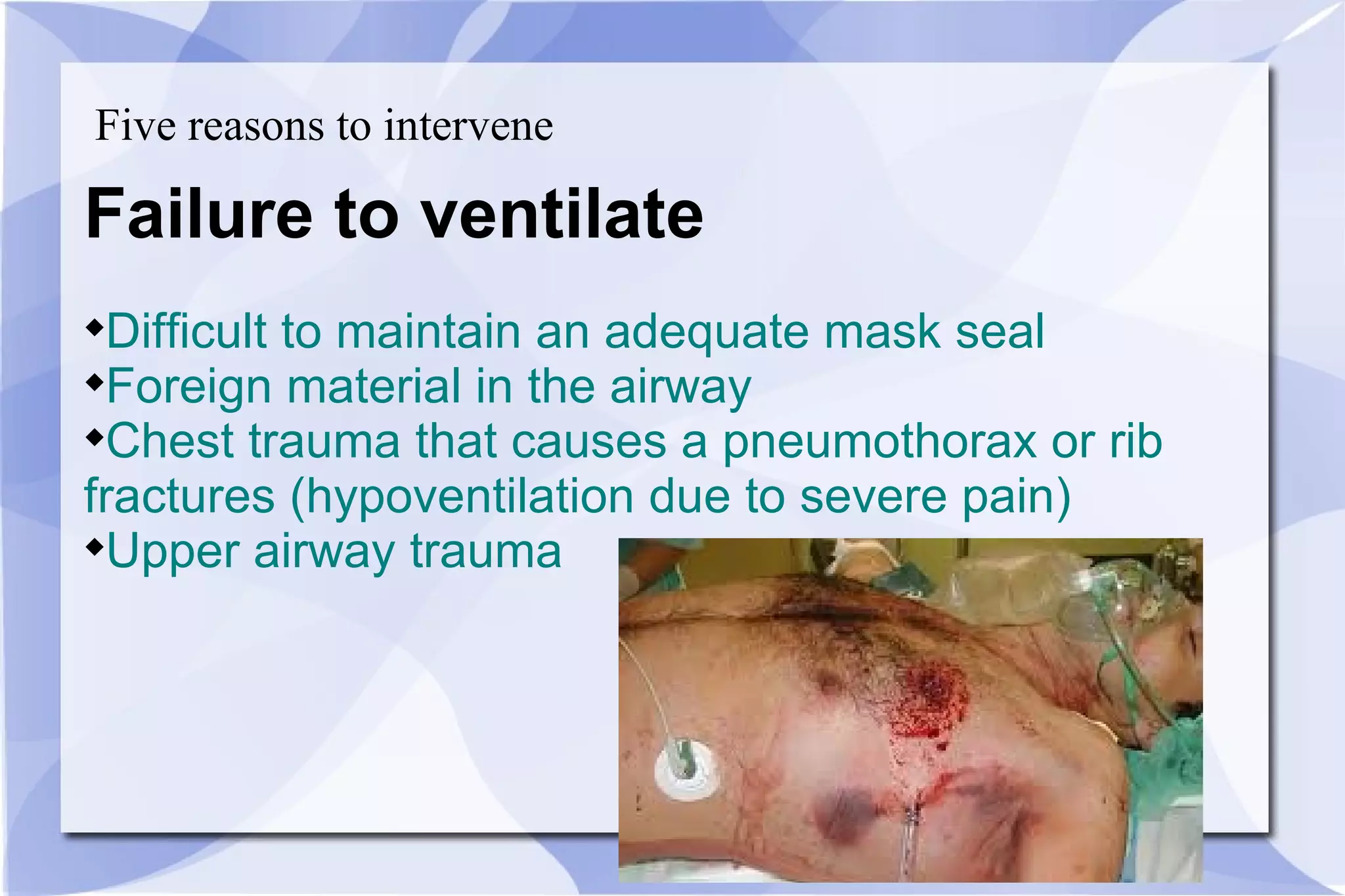 Airway and breathing | PPT