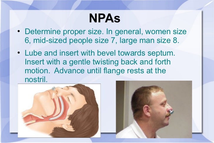 Airway and breathing