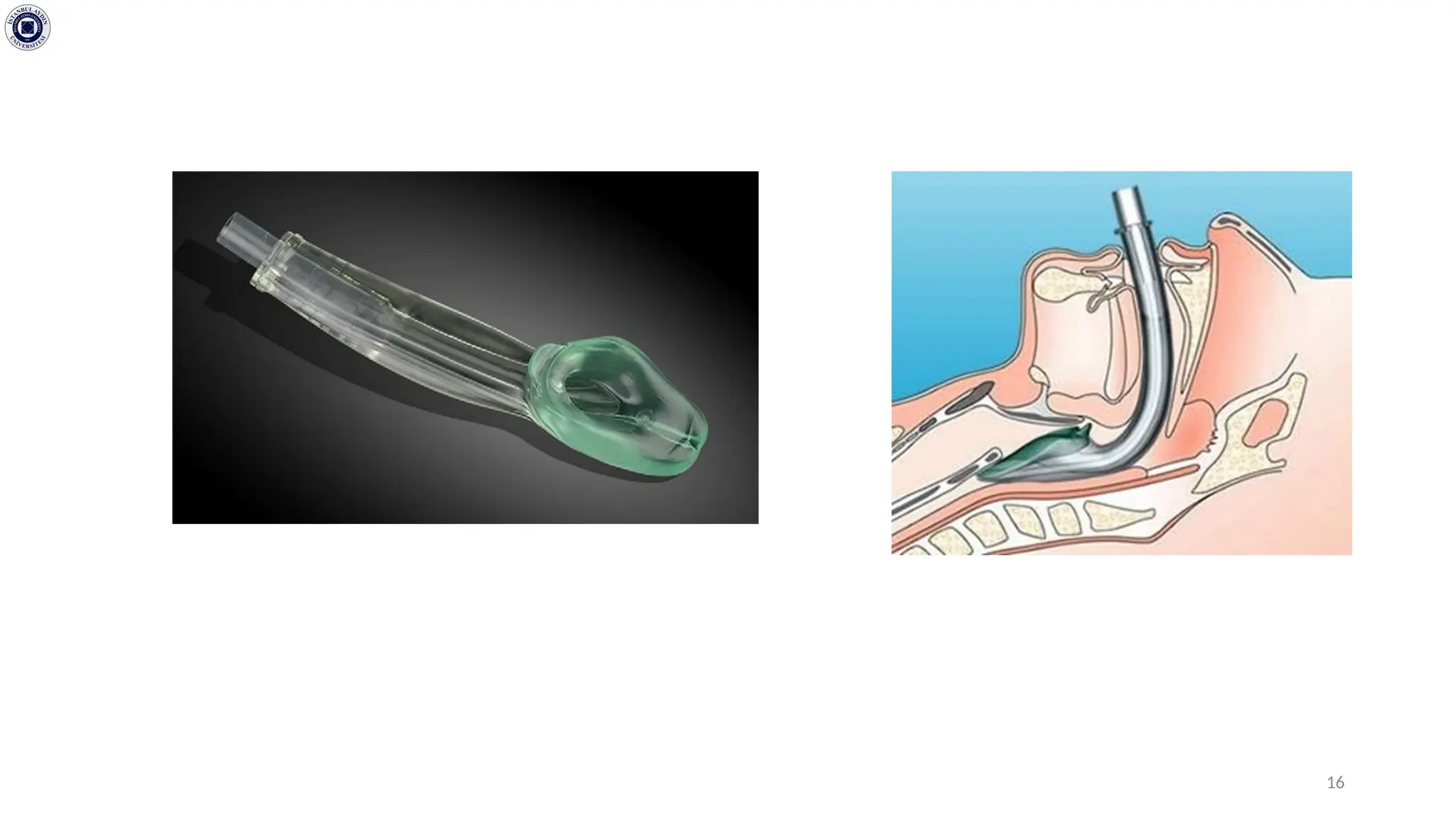 Anesthesia and Reanimation: AIRWAY and ENTUBATION.pptx | Ear, Nose and ...