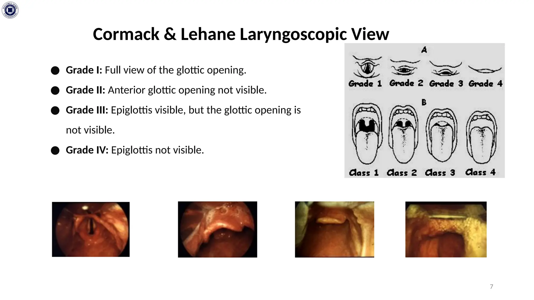 Anesthesia and Reanimation: AIRWAY and ENTUBATION.pptx | Ear, Nose and ...