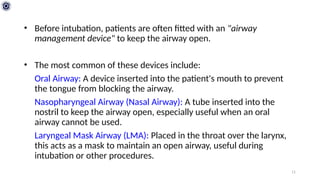 Anesthesia and Reanimation: AIRWAY and ENTUBATION.pptx