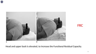 Anesthesia and Reanimation: AIRWAY and ENTUBATION.pptx