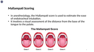 Anesthesia and Reanimation: AIRWAY and ENTUBATION.pptx