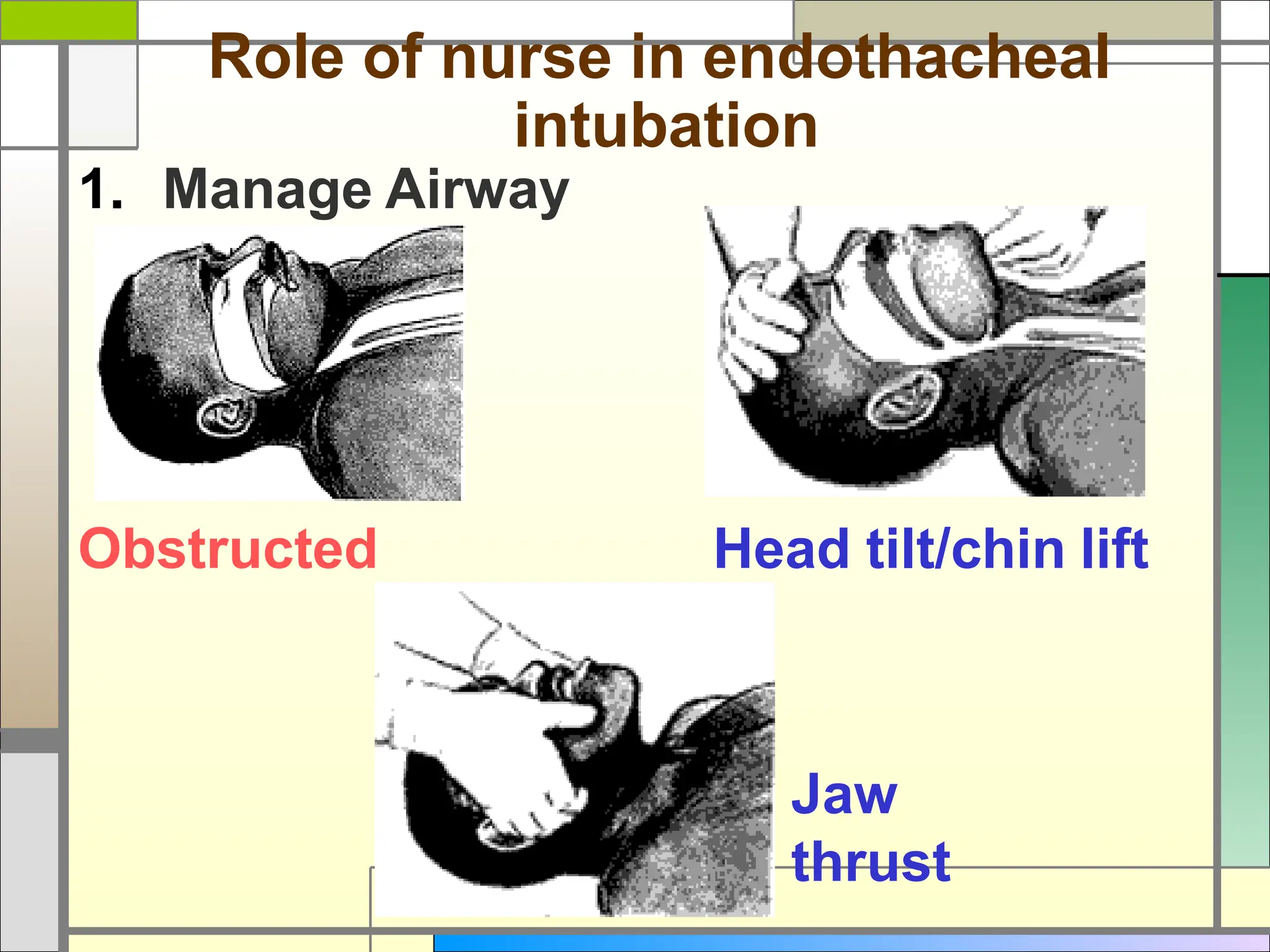 airway and ventilation for nursing ppt.pptx