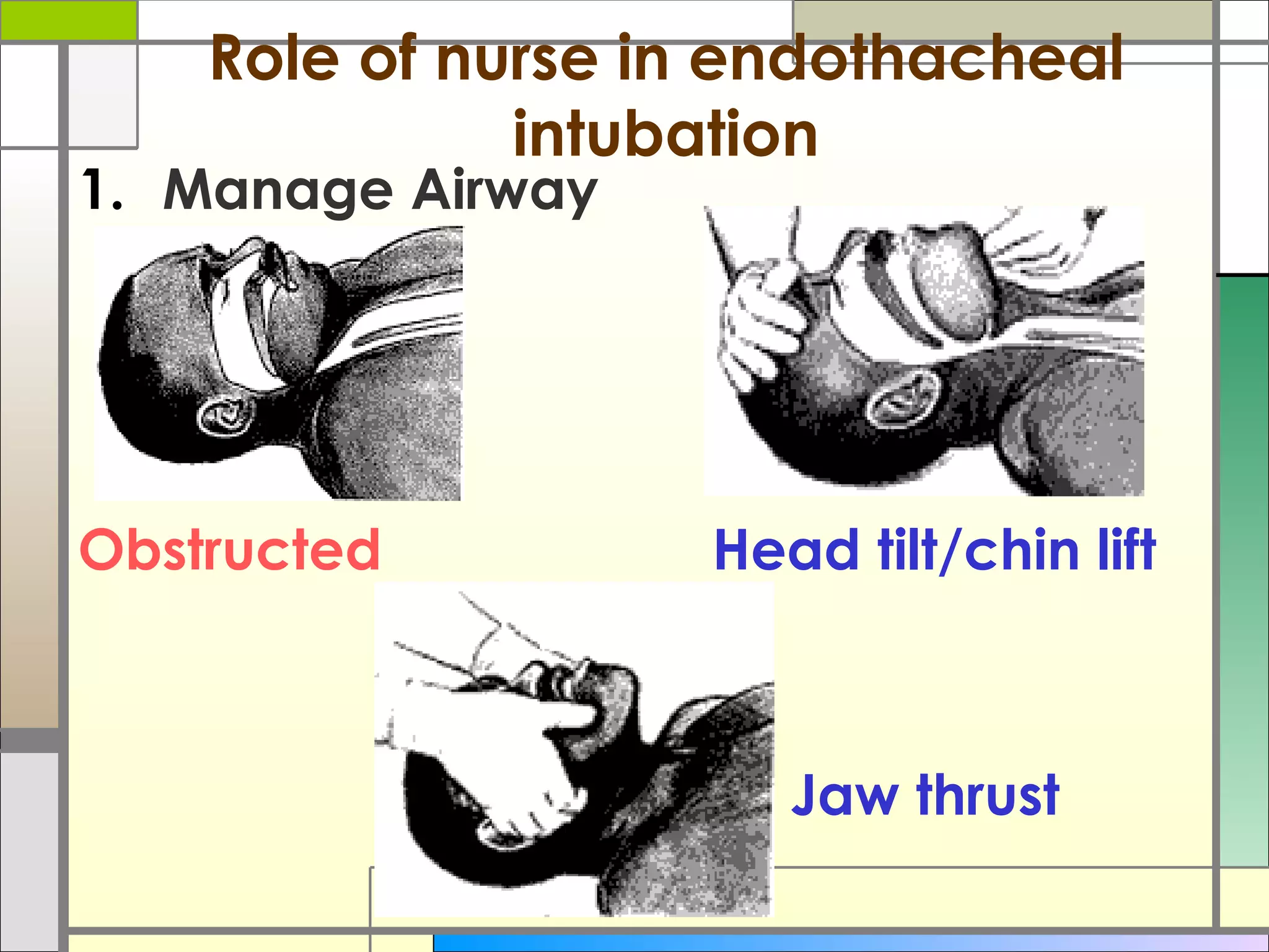 Airway and ventilation management | PPT