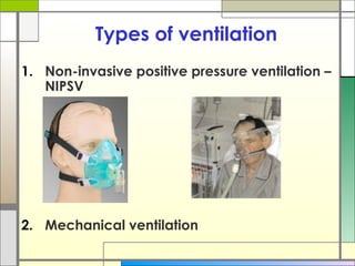 Airway and ventilation management | PPT