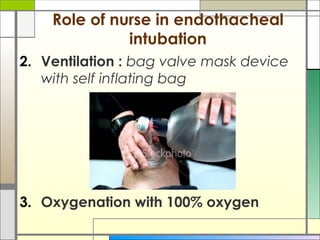 Airway and ventilation management | PPT