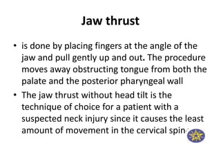 airway assesement.pptx