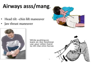 airway assesement.pptx