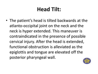 airway assesement.pptx