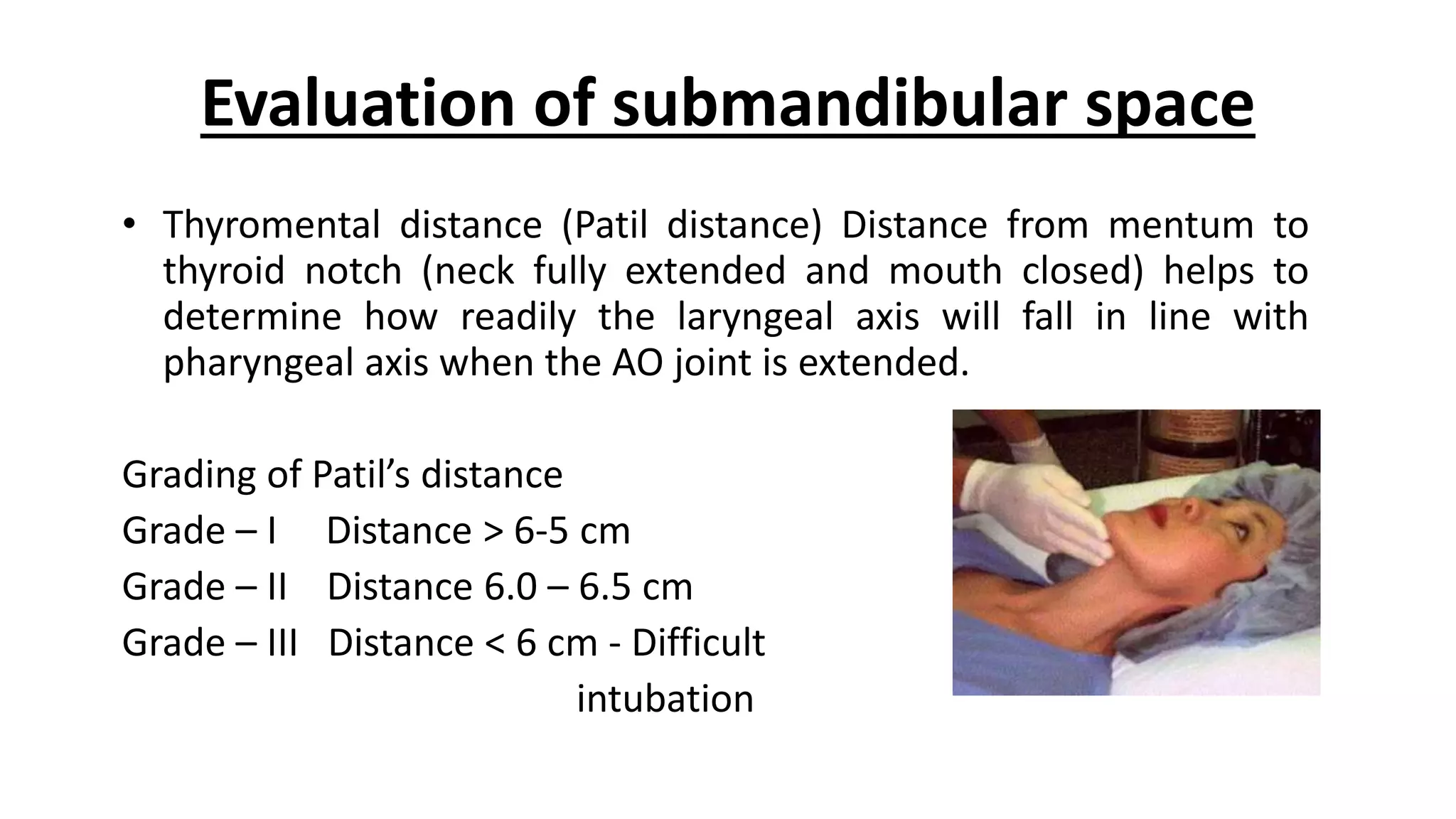 Airway assesment IN ANESTHESIA | PPTX