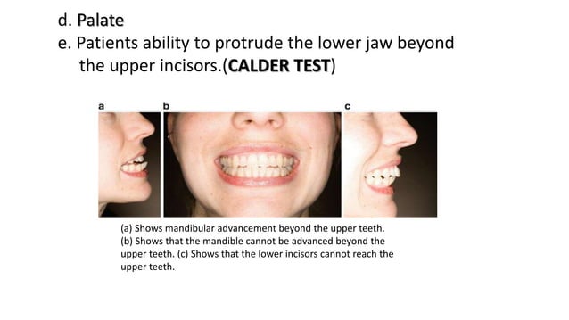 Airway assesment IN ANESTHESIA | PPTX