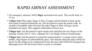 airway assesment.pptx airway and assessment | PPTX