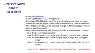 Airway assesment part 1 | PPTX