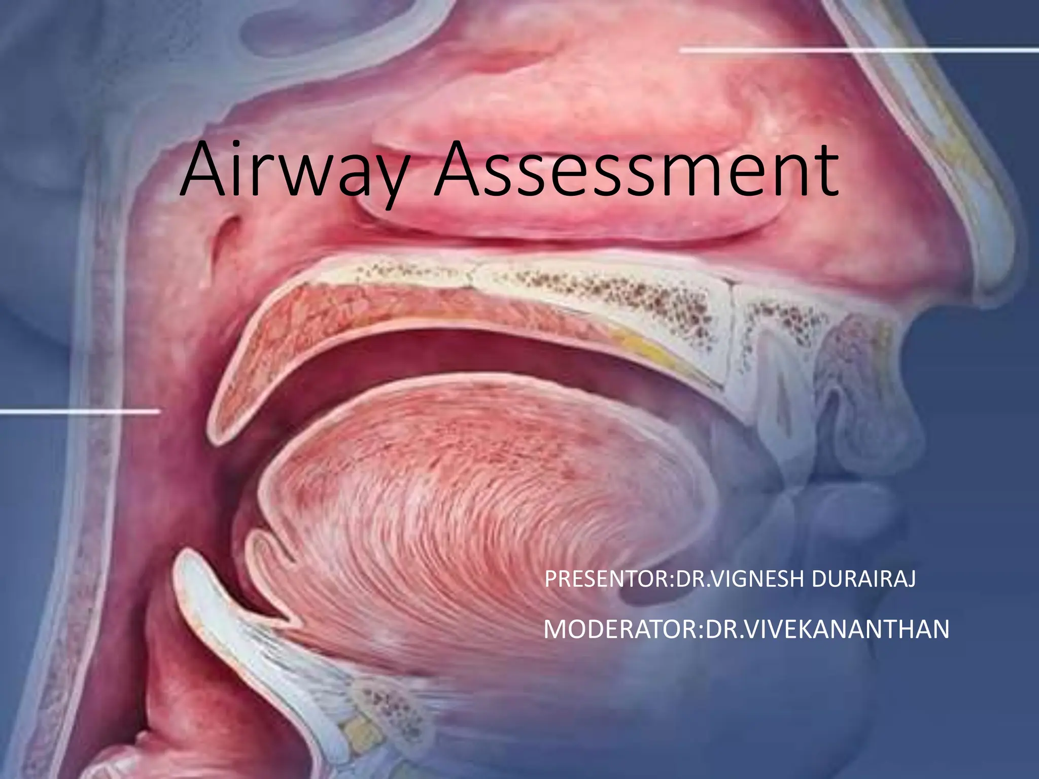 Airway Assessment in surgery patients -implications | PPT
