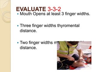 Airway assessment | PPTX