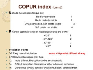 Airway assessment | PPTX