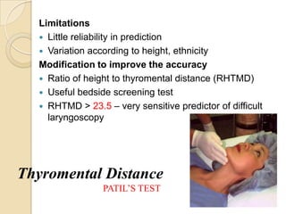 Thyromental Distance
