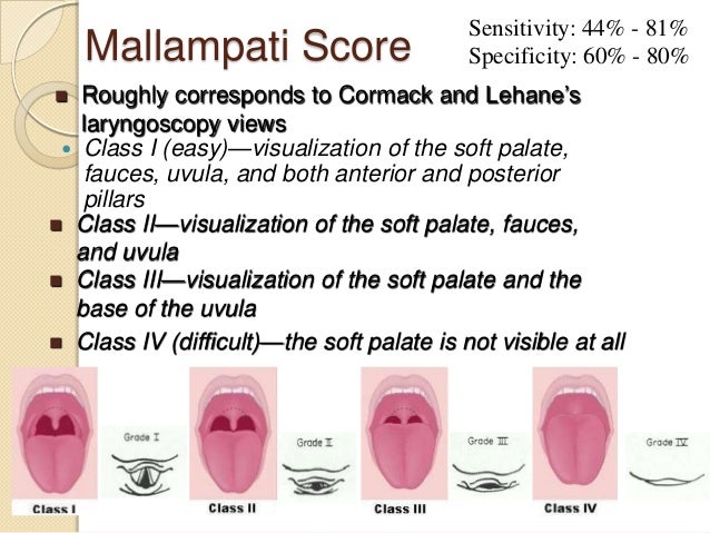 Airway assessment