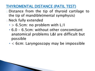 Airway assessment | PPTX