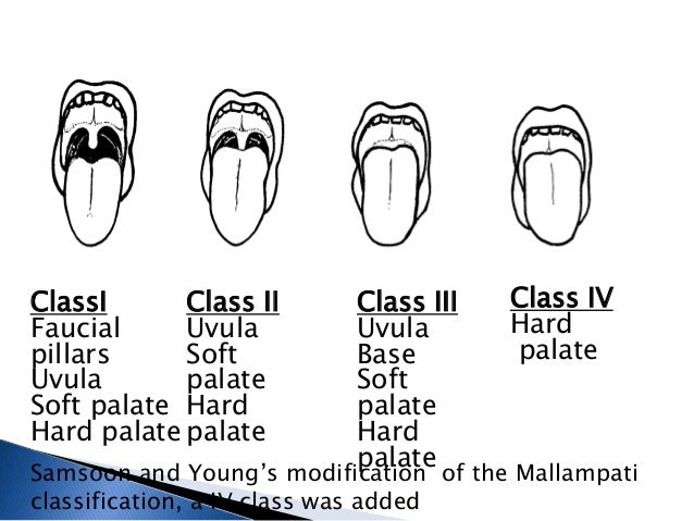 Airway assessment