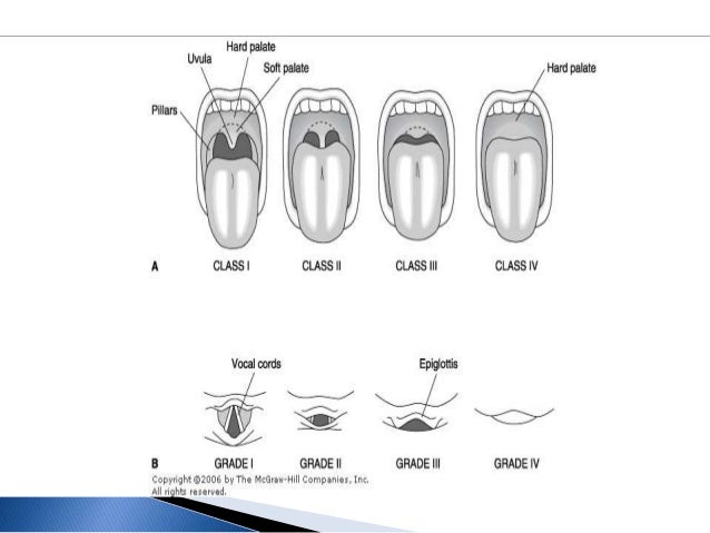 Airway assessment