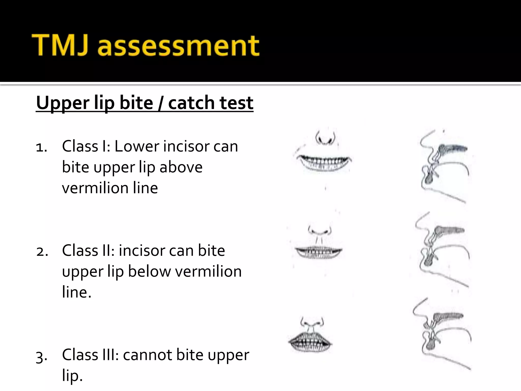Airway assessment Dr. Tushar | PPTX