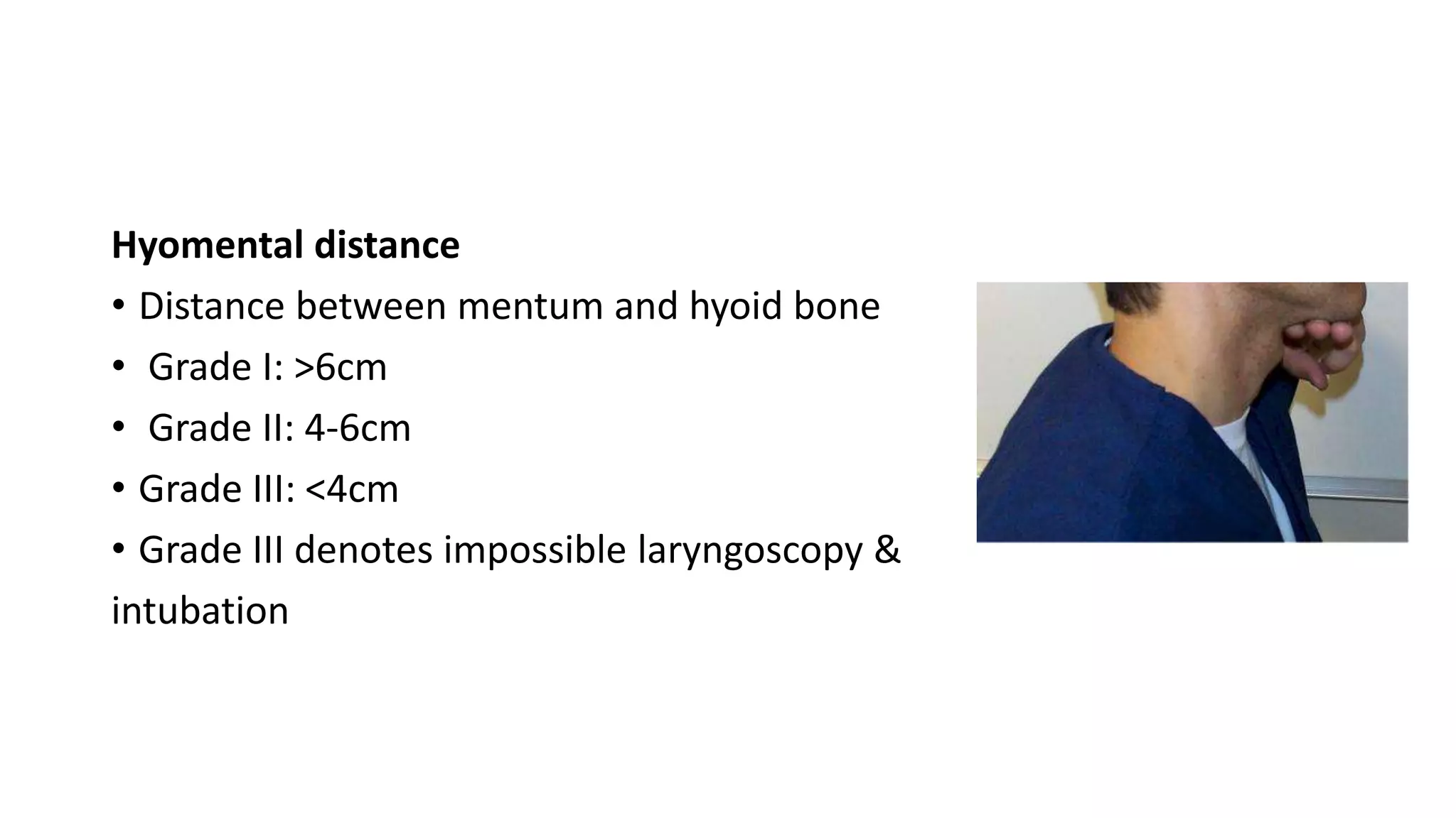 Airway assessment | PPTX