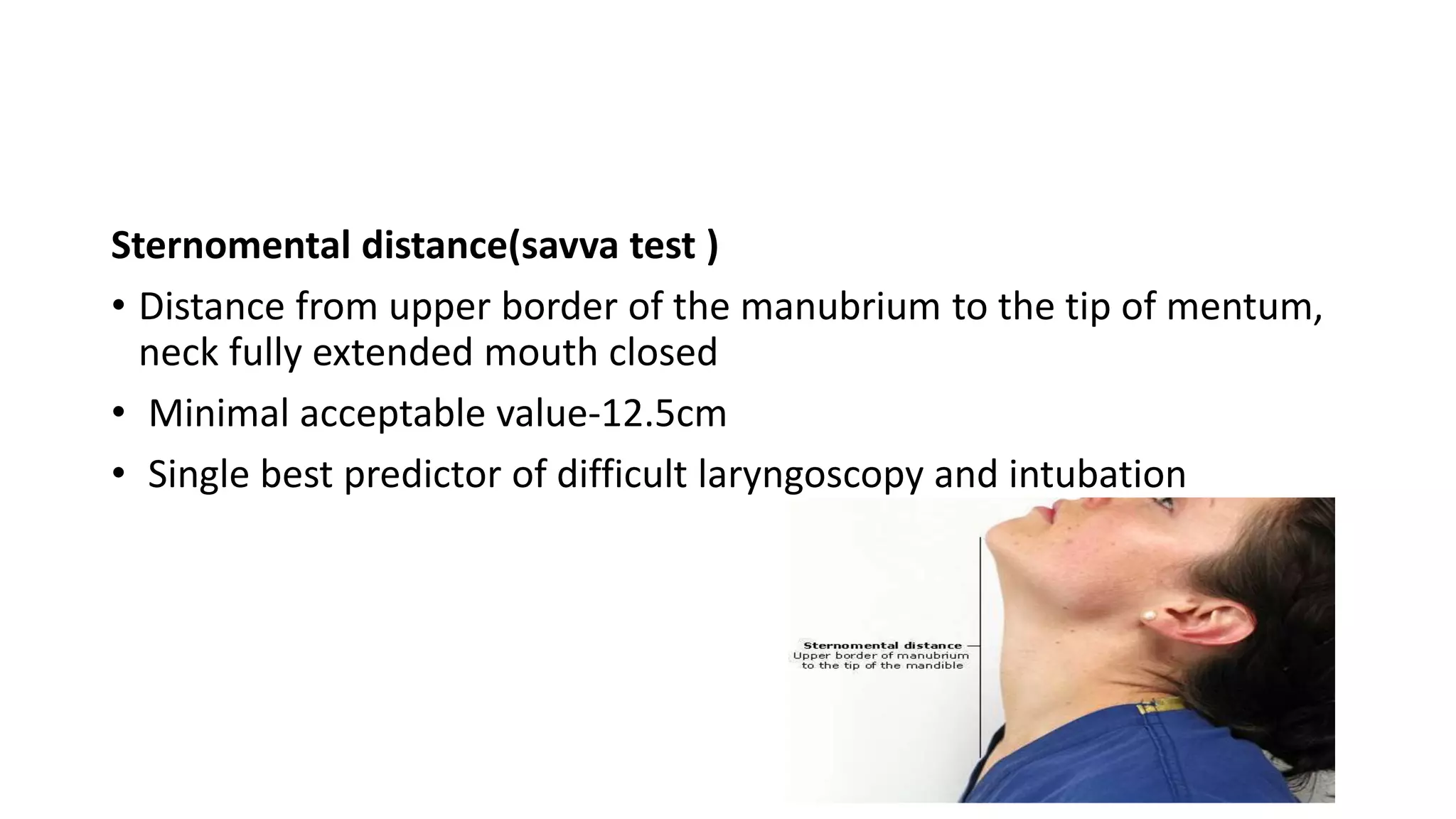 Airway assessment | PPTX