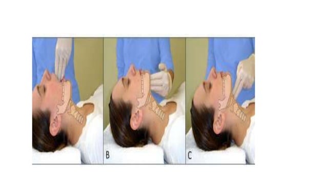 Airway assessment | PPTX | Ear, Nose and Throat Conditions | Diseases ...