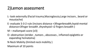 Airway assessment | PPT