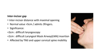 Airway assessment | PPT