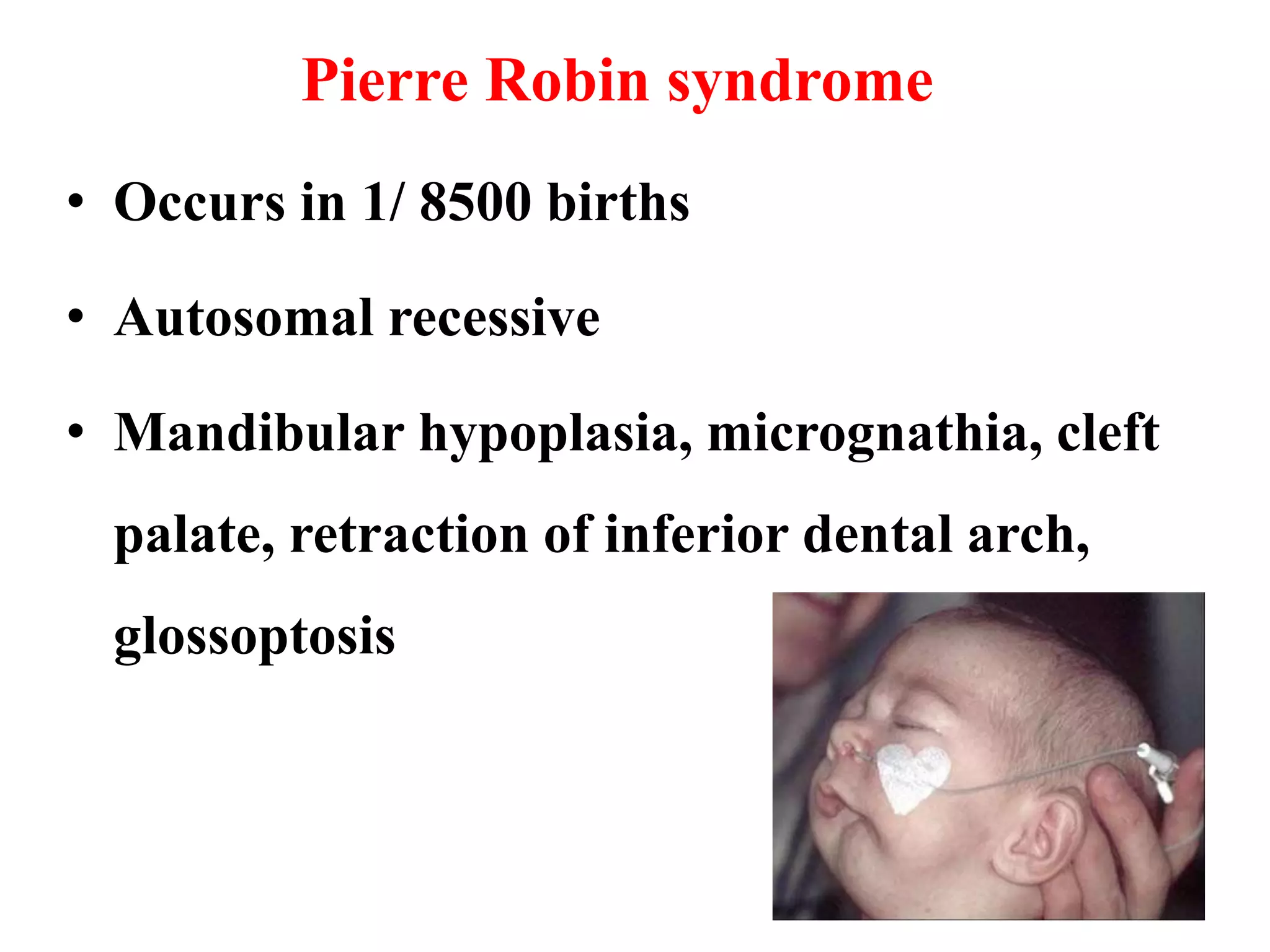 AIRWAY ASSESSMENT IN PAEDIATRICS PATIENTS-LARYNGOSCOPY, INTUBATION | PPTX