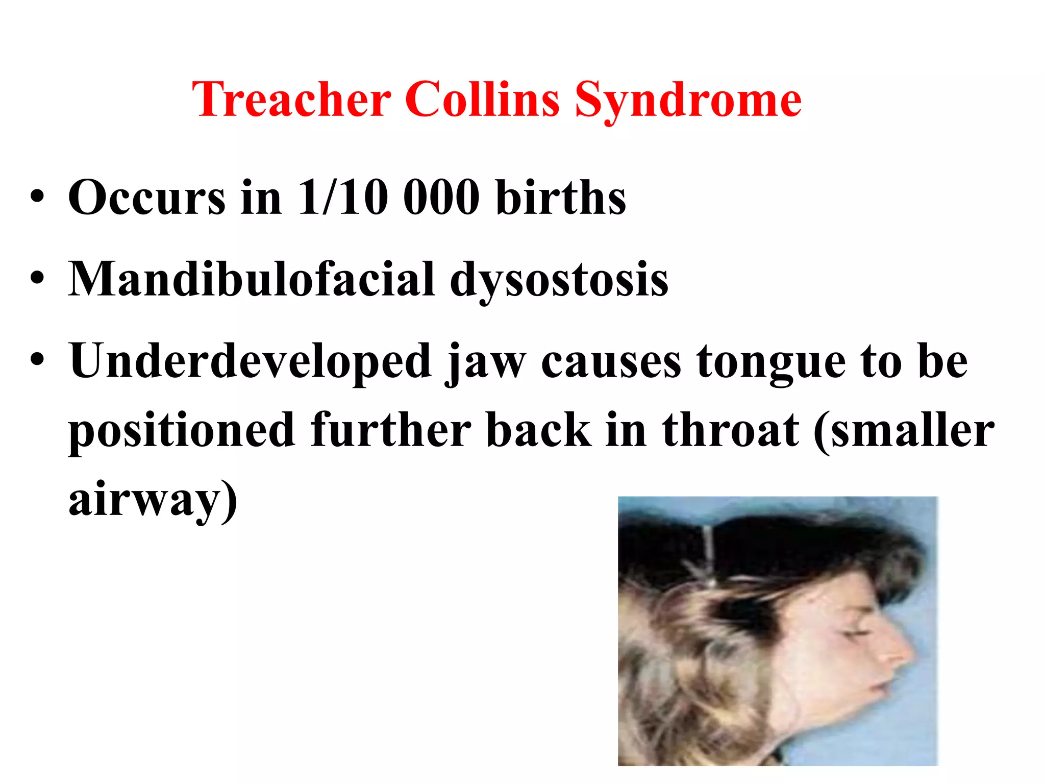 AIRWAY ASSESSMENT IN PAEDIATRICS PATIENTS-LARYNGOSCOPY, INTUBATION | PPTX