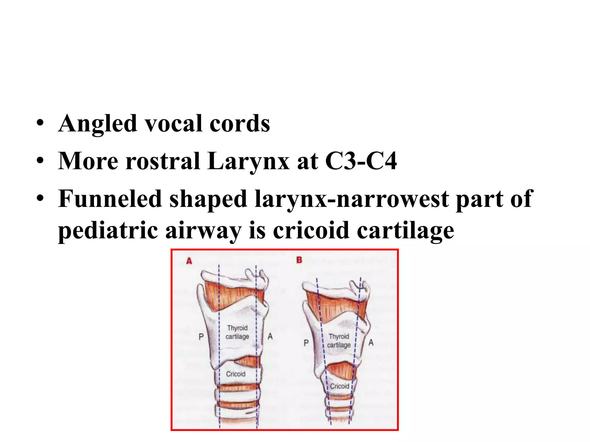AIRWAY ASSESSMENT IN PAEDIATRICS PATIENTS-LARYNGOSCOPY, INTUBATION | PPTX