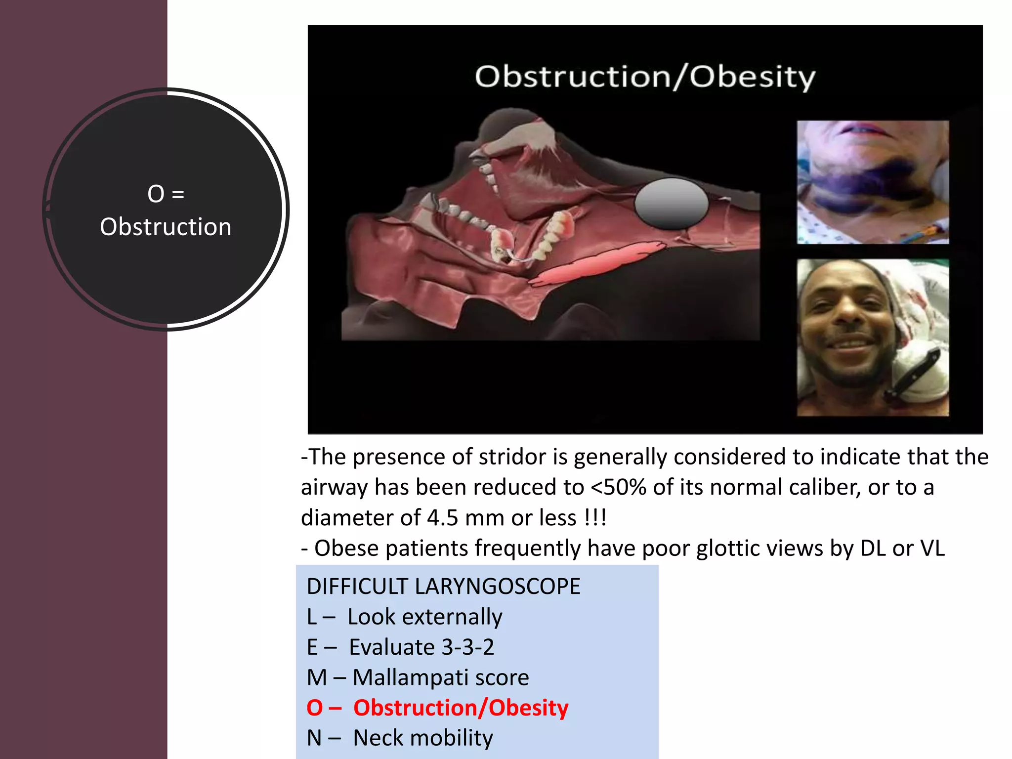 AIRWAY ASSESSMENT.ppt