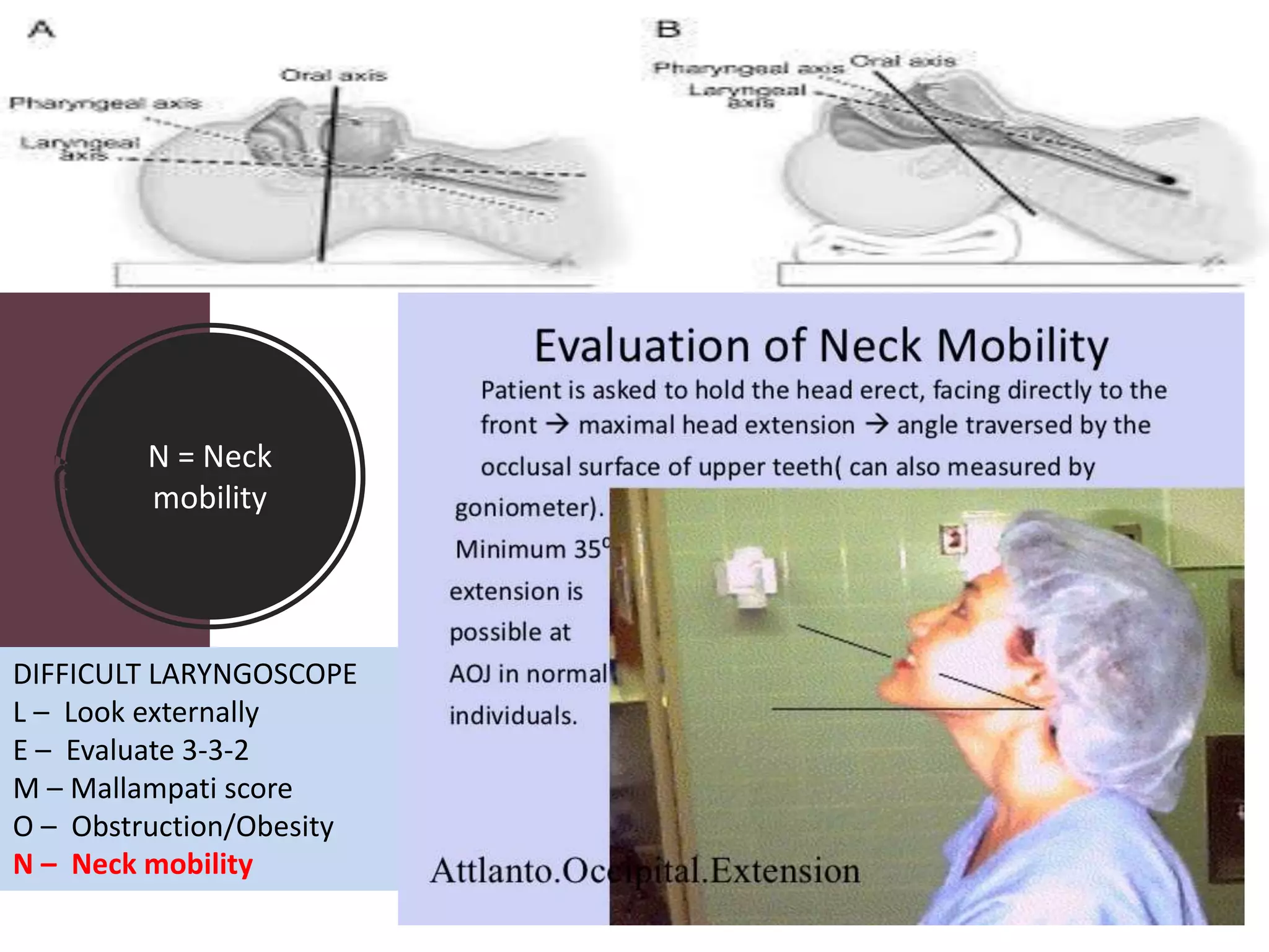 AIRWAY ASSESSMENT.ppt