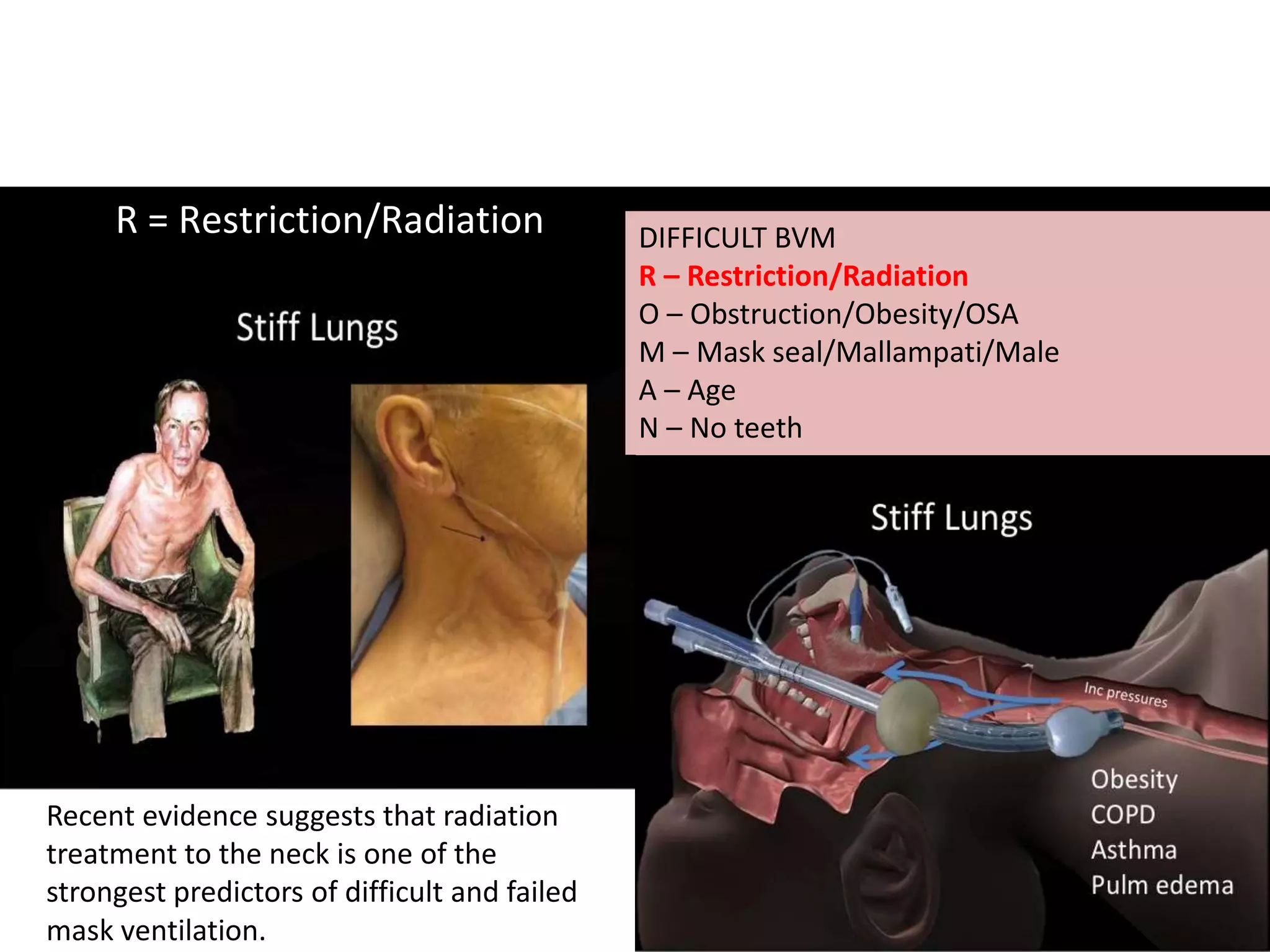 AIRWAY ASSESSMENT.ppt