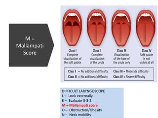 AIRWAY ASSESSMENT.ppt