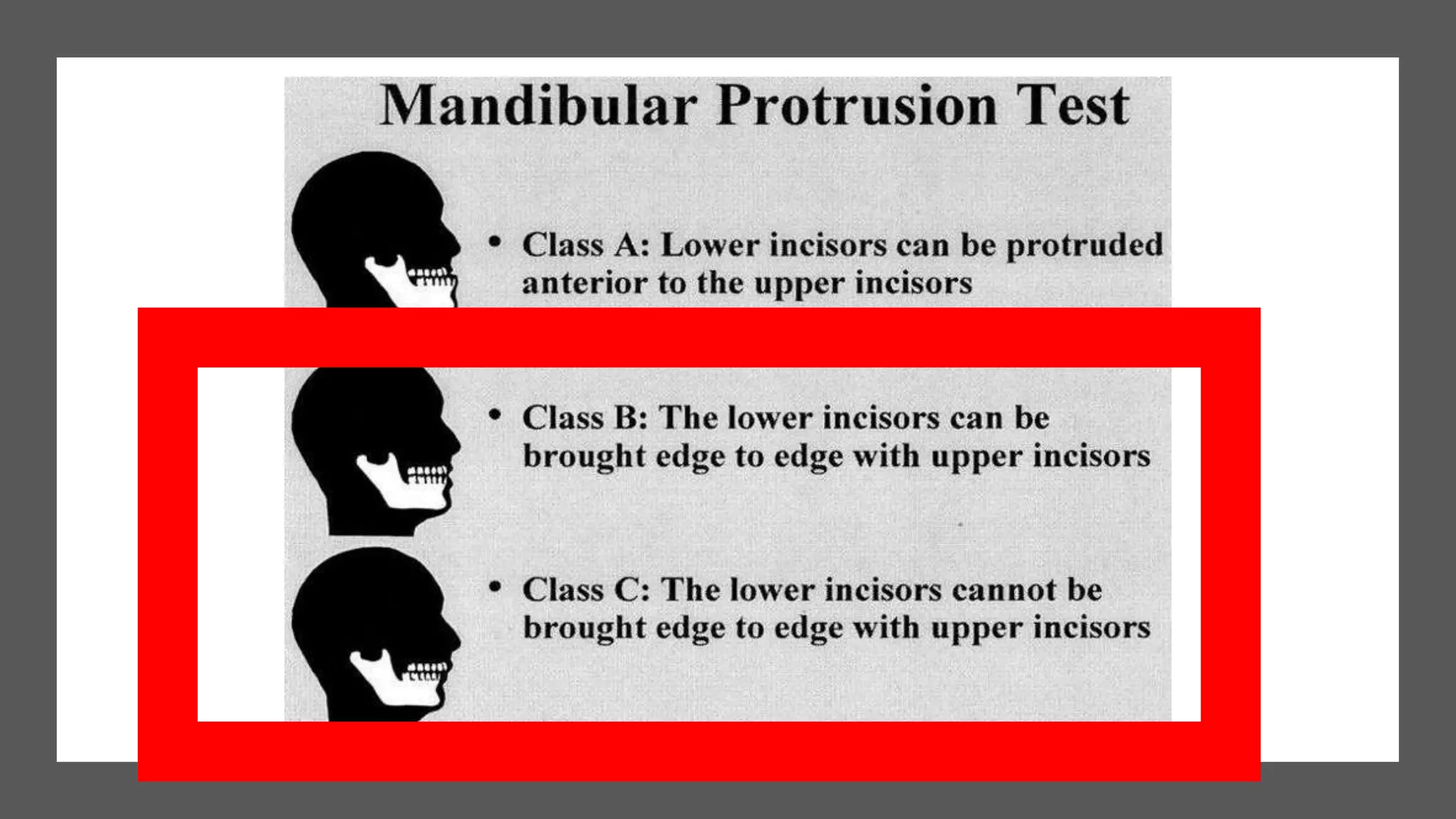 airway assessment.pptx