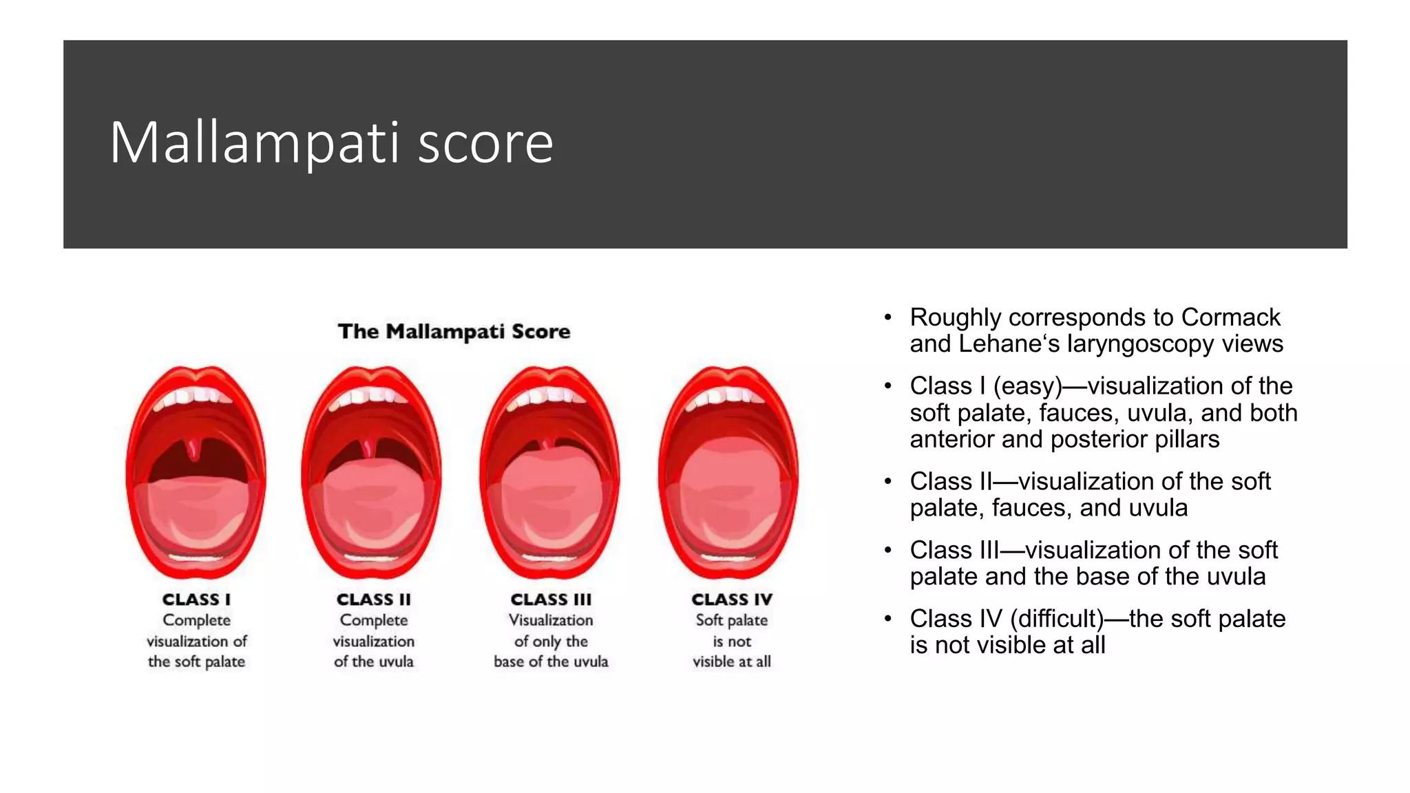 airway assessment.pptx