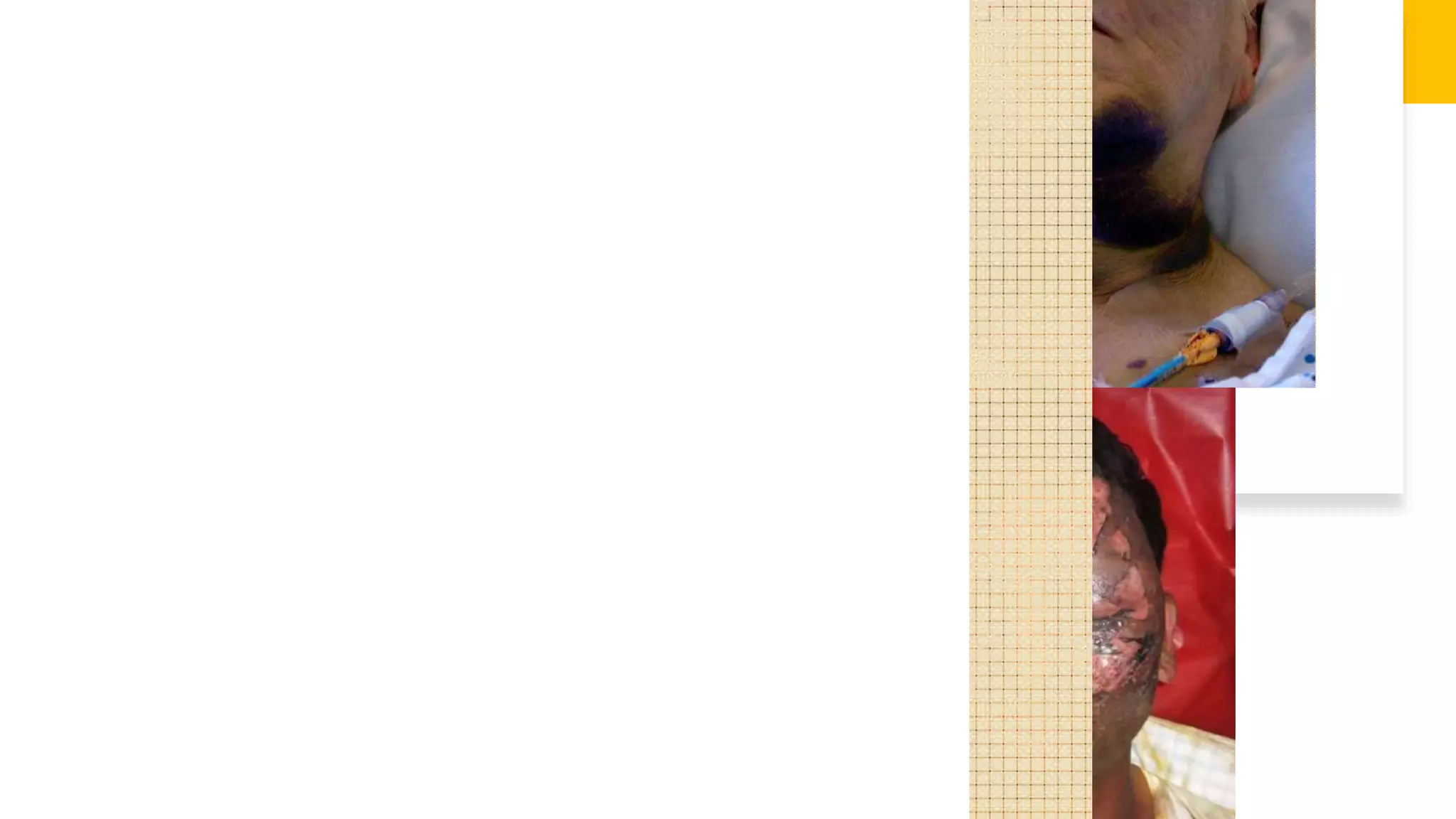 airway assessment.pptx