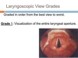 Assessment and management of Airway for BSc Nuursing Students | PPTX