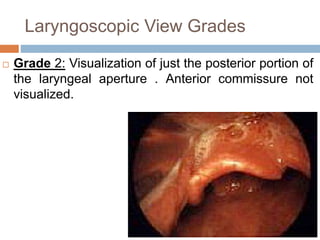 Assessment and management of Airway for BSc Nuursing Students | PPTX
